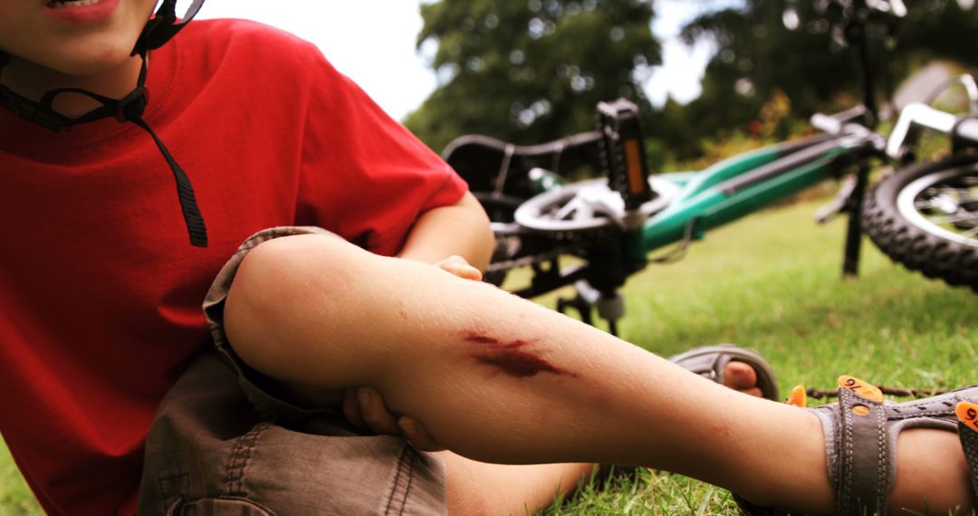 Child Showing Scraped Knee After Fall from Bicycle